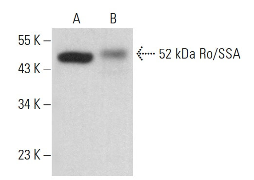 Anti-52 kDa Ro/SSA Antibody (D-12) | 圣克鲁斯生物技术