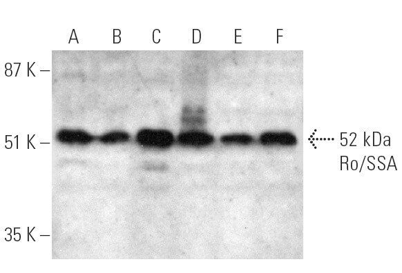 Anti-52 kDa Ro/SSA Antibody (D-12) | 圣克鲁斯生物技术