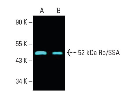 Anti-52 kDa Ro/SSA Antibody (D-12) | 圣克鲁斯生物技术