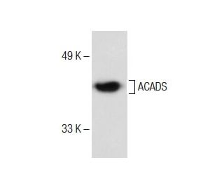 ACADS抗体 (G-10) | Santa Cruz Animal Health