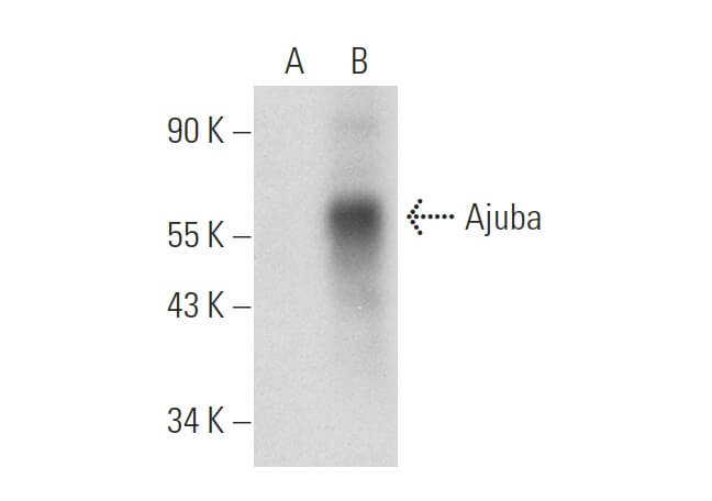 Ajuba Antibody (F-11) | 圣克鲁斯生物技术