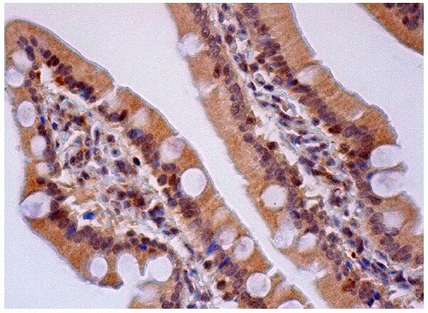 ARF1 Antibody (ARFS 3F1) | 圣克鲁斯生物技术