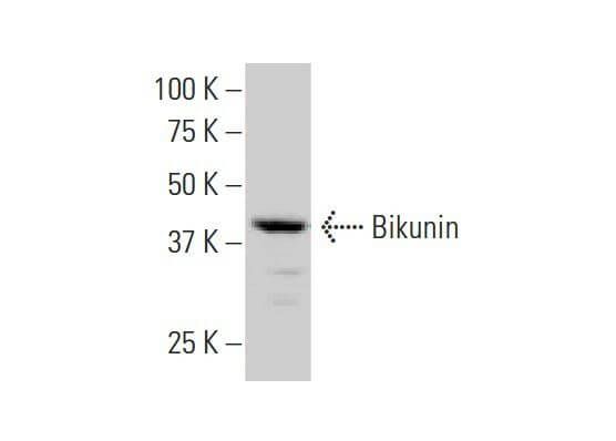 Bikunin抗体 (3F1) | SCBIO - Santa Cruz Biotechnology
