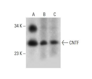 CNTF 항체 (R-20) | SCBIO - Santa Cruz Biotechnology