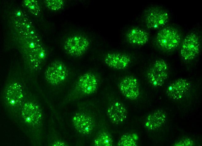 coilin Antibody (F-7) | 圣克鲁斯生物技术