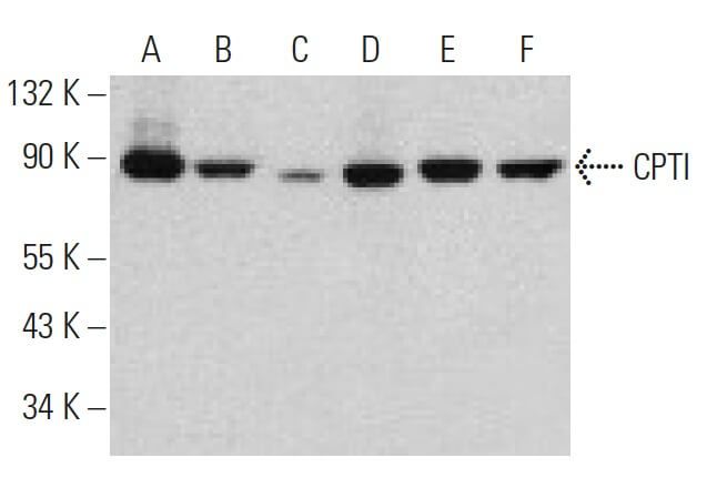 CPTI抗体 (E-7) | SCBIO - Santa Cruz Biotechnology
