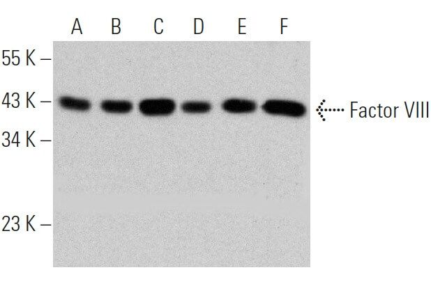 Factor VIII抗体 (R8B12) | SCBIO - Santa Cruz Biotechnology