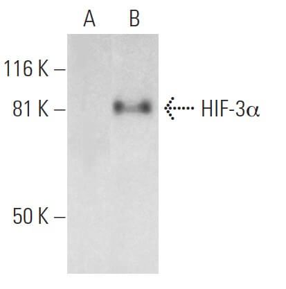 HIF-3α抗体 (D-7) | SCBIO - Santa Cruz Biotechnology