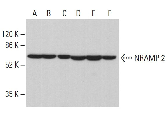Anti-NRAMP 2 Antibody (G-5) | 圣克鲁斯生物技术