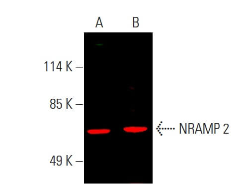Anti-NRAMP 2 Antibody (G-5) | 圣克鲁斯生物技术