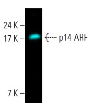 p14ARF Antibody (ARF 4C6/4) | 圣克鲁斯生物技术