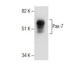 Pax-7抗体 (PAX7) | SCBIO - Santa Cruz Biotechnology