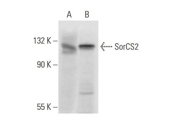 SorCS2抗体 (A-10) | SCBIO - Santa Cruz Biotechnology