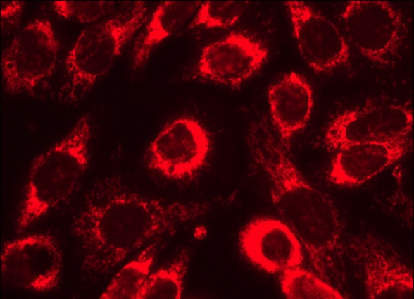 Anti-Tom20 Antibody (F-10) | 圣克鲁斯生物技术