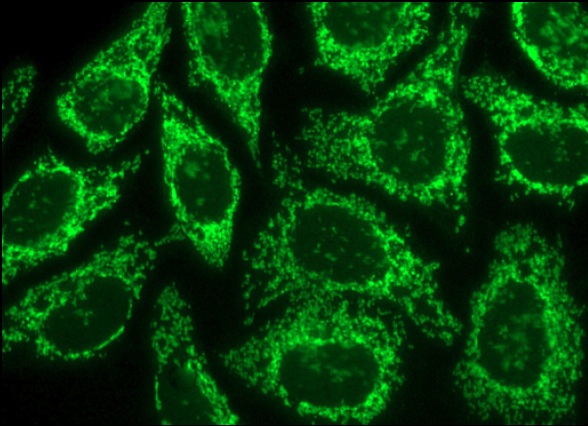 Tom20 Antibody (F-10) | 圣克鲁斯生物技术