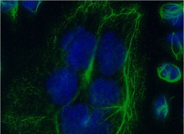 UltraCruz® Hard-set Mounting Medium with DAPI | SCBIO - Santa Cruz ...
