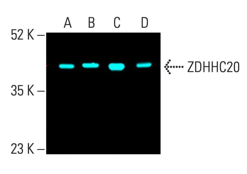 ZDHHC20抗体 (A-4) | SCBIO - Santa Cruz Biotechnology